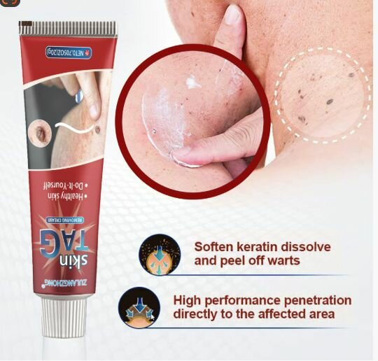 Крем косметиЧеский локального применениЯ от паппилом и бородавок/Средство от папиллом и бородавок DODOYURI гель /20г