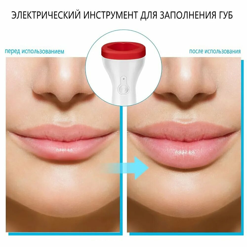 Косметологический аппарат, для ухода за кожей лица, SKU00186