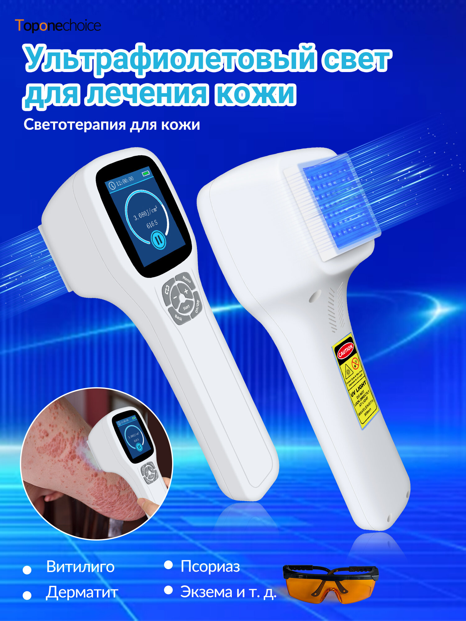 УФБ 308 нм фототерапия лампа 49 диодов ручной аппарат для кожи
