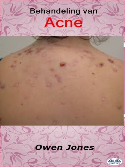 Behandeling Van Acne [Цифровая книга]