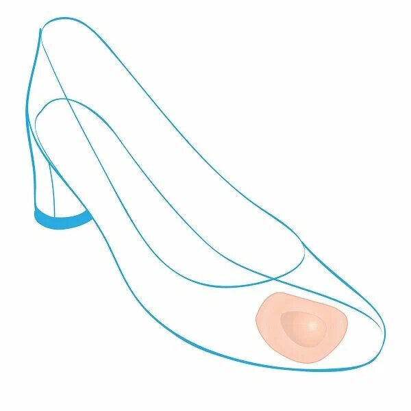 Подушечки ортопедические "Крейт", для стоп, силикон, универсальные, С-120