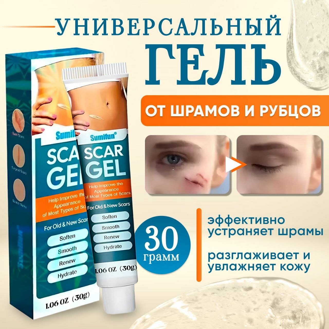 Заживляющий крем от шрамов, ожогов, постакне. Крем от рубцов и растяжек