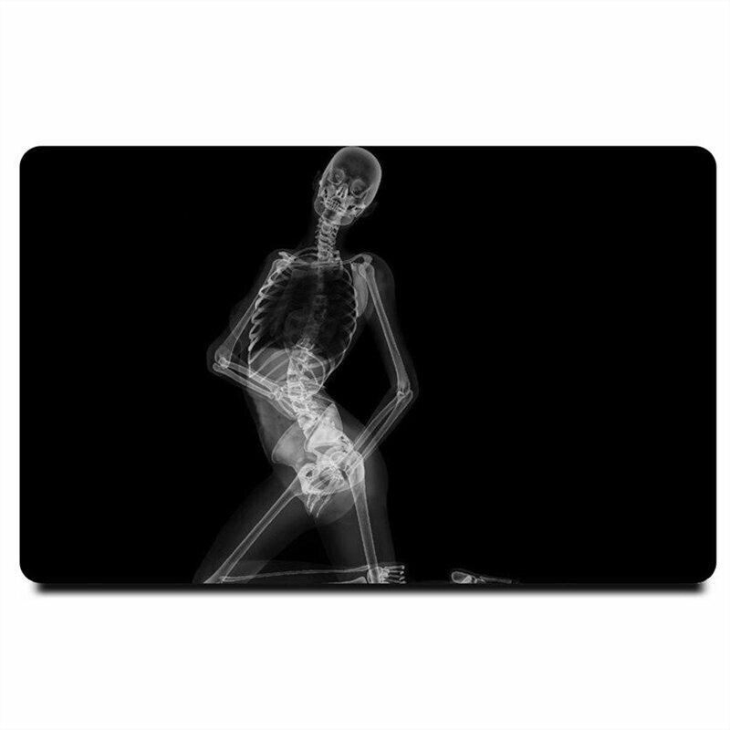 Магнит на холодильник "Эротическое фото через рентген" 5 шт.