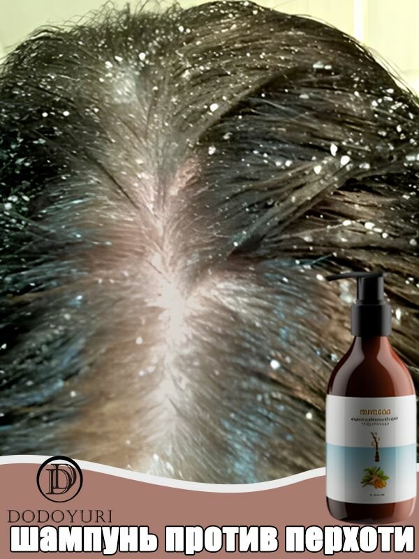 DODOYURI Интенсивный шампунь против перхоти, от шелушения и выпадения волос, для сухих волос, шампунь против перхоти, восстанавливающий уход, 300 мл