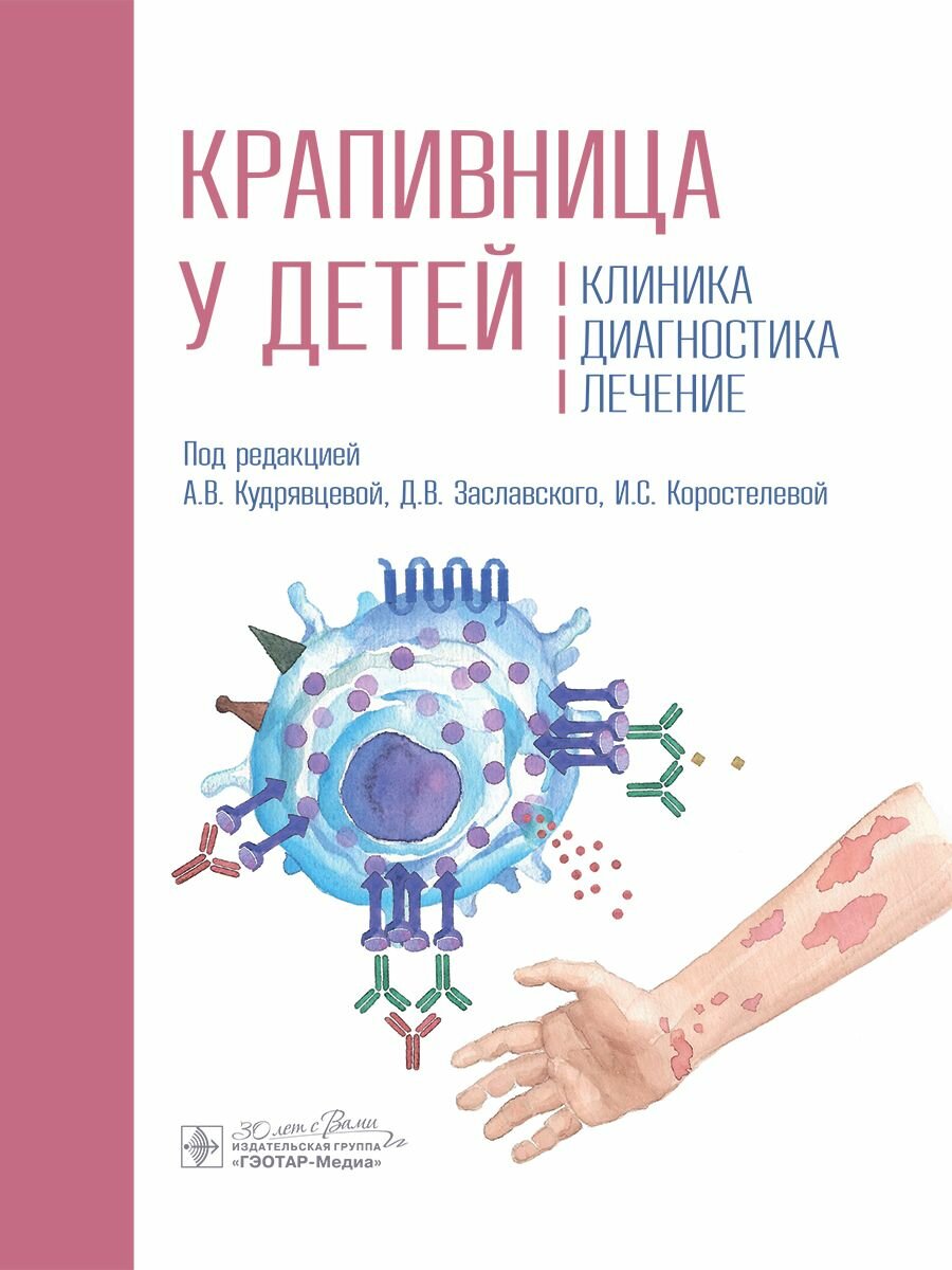 Книга "Крапивница у детей. Клиника, диагностика, лечение", твердый переплет, 2025 г