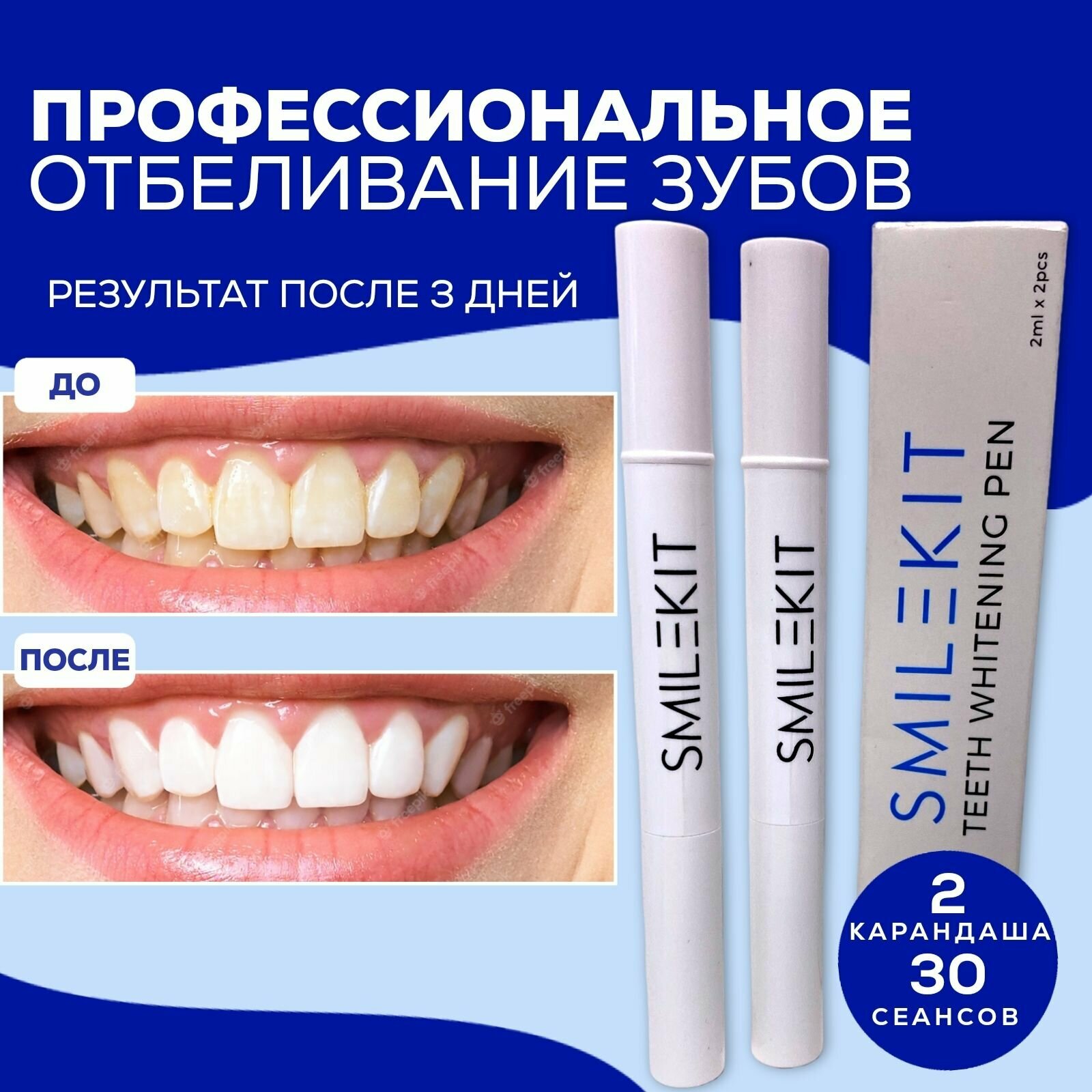 Карандаш для отбеливания зубов SMILEKIT, домашний осветляющий гель-пен без перекиси, удобный touch-up карандаш для поддержания белизны эмали, компактный и экономный, 5 дней до видимого результата