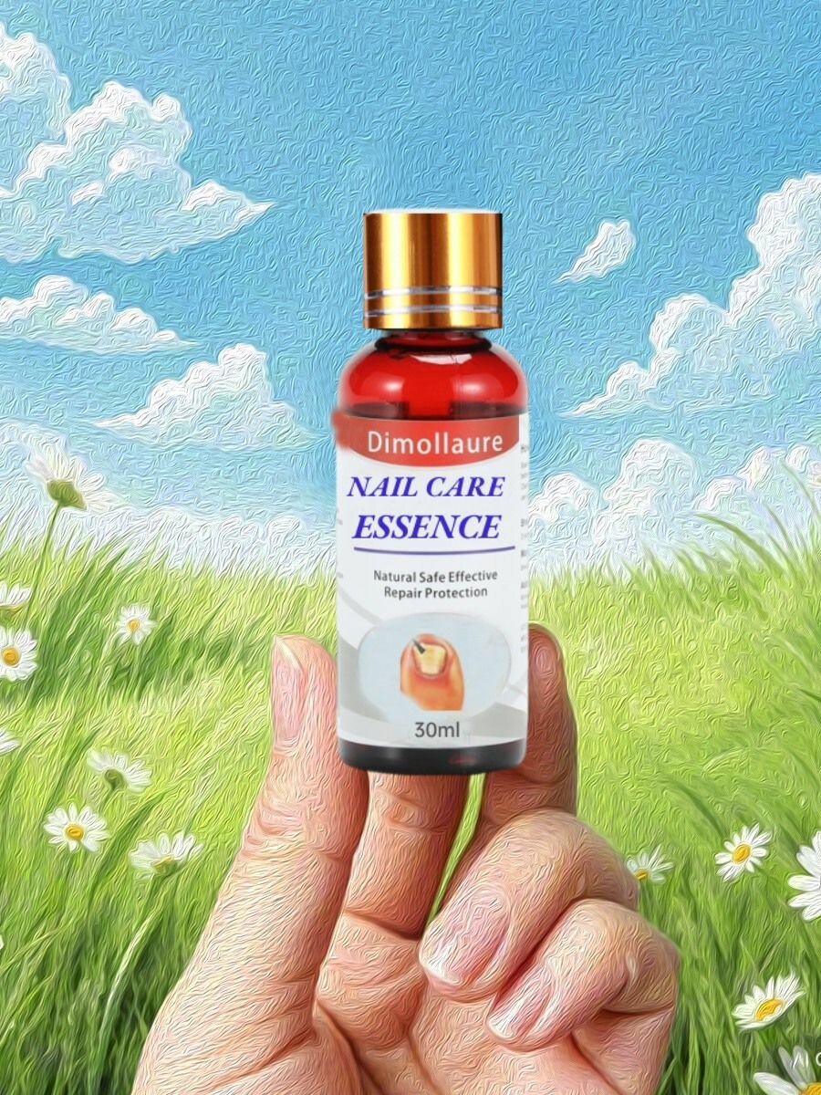 Сильная эссенция для лечения грибка ногтей, удаление грибка ногтей на ногах, 30 мл