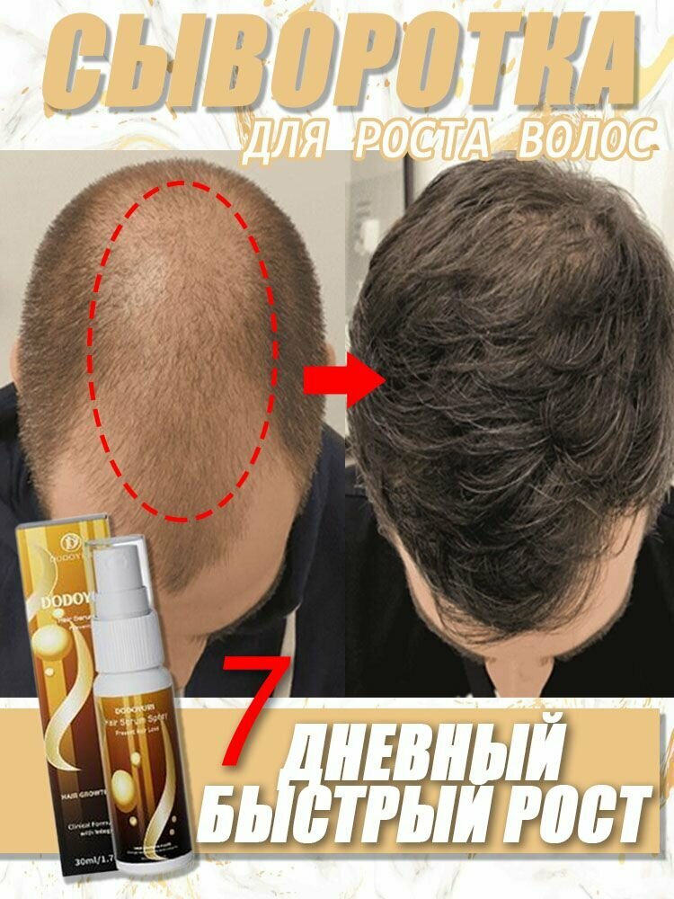 Сыворотка для роста волос с натуральными экстрактами, укрепление корней, против выпадения, 30 мл