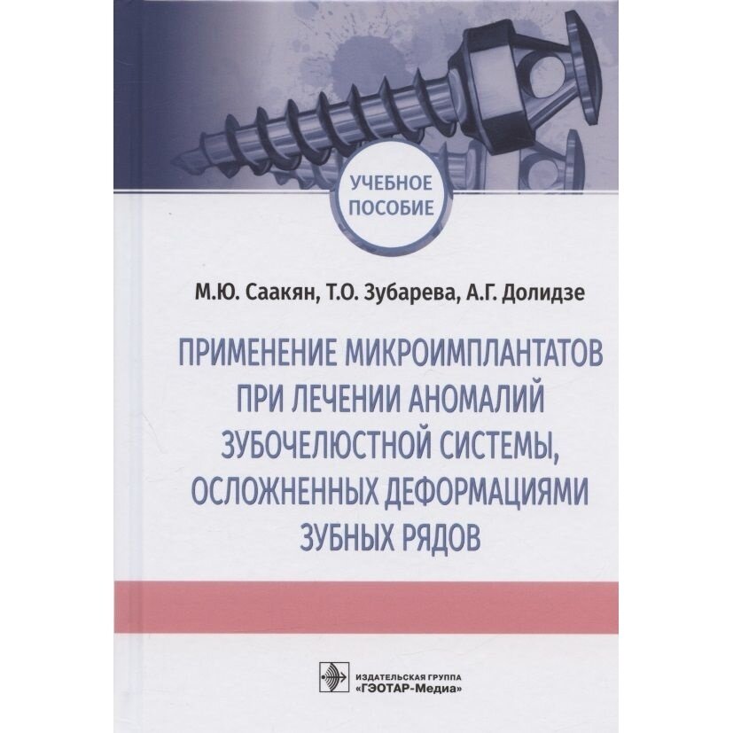 Книга гэотар-медиа Применение микроимплантатов при лечении аномалий зубочелюстной системы, осложненных деформациями. 2022 год, Саакян, Зубарева