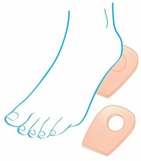 Подпяточники ортопедические C-201, размер S (размер обуви 37-40), силиконовый со съемной вставкой, пара.