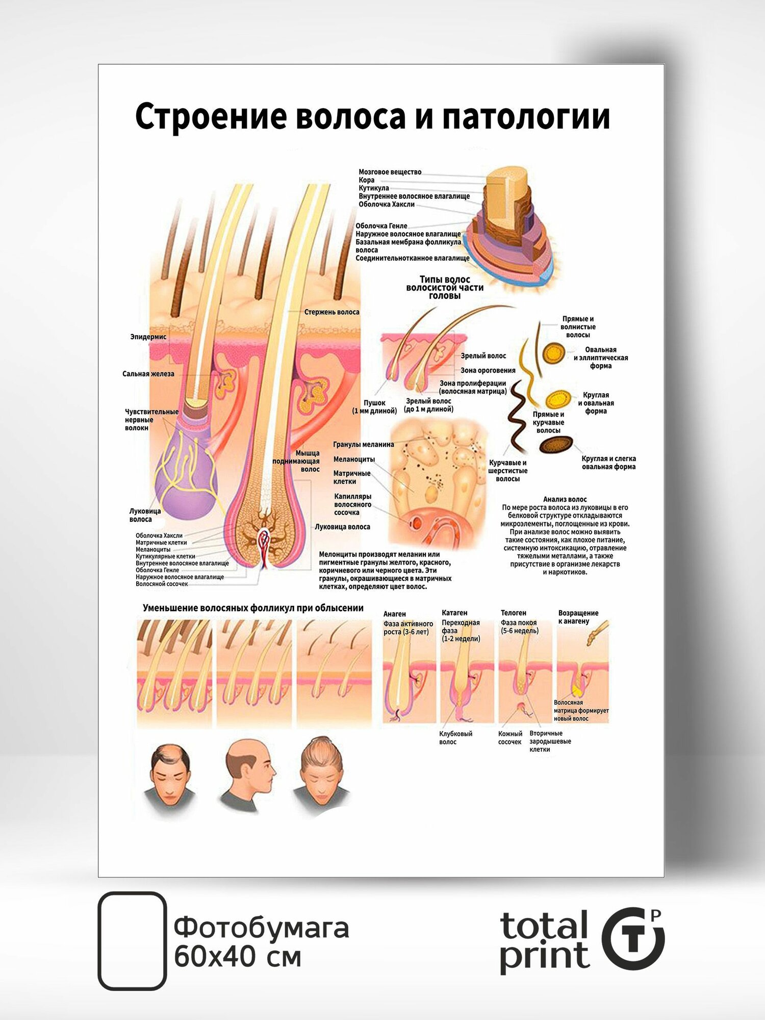 Постер на медицинскую тематику, 60х40см, Строение волоса и патологии, TotalPrint