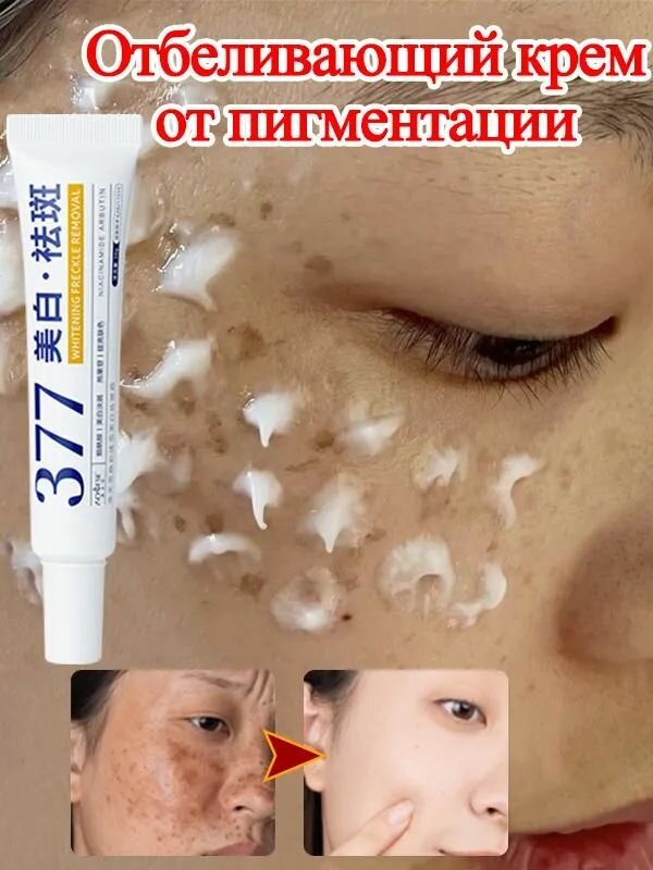 Отбеливающий крем от пигментации, 30 г, осветление пигментации, отбеливание и увлажнение