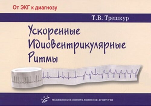 Ускоренные идиовентрикулярные ритмы. Клинико-электрокардиографические особенности, систематизация по ЭКГ-характеристикам, дифференцирование с другими нарушениями ритма и аномалиями проводимости