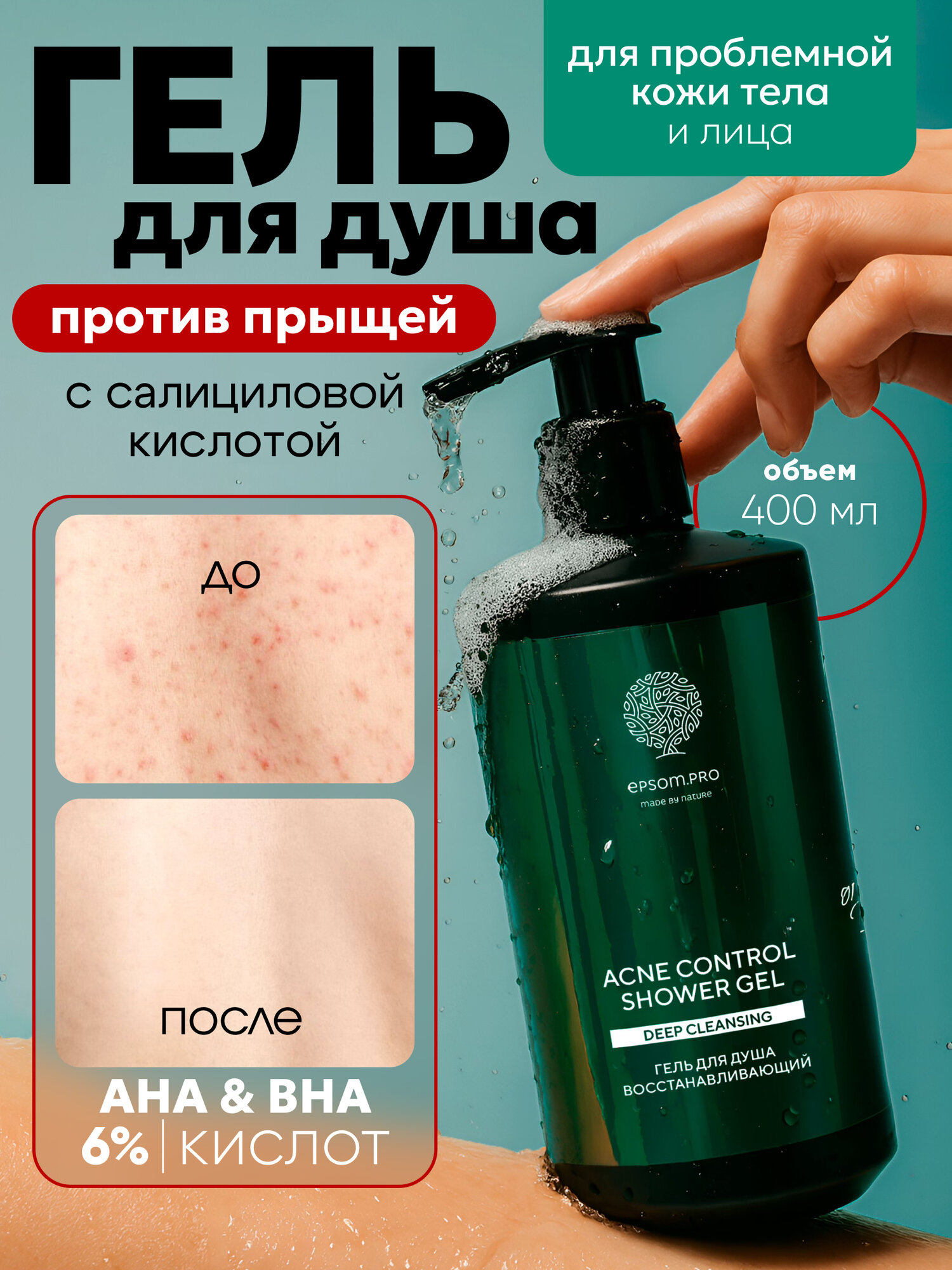 Очищающий гель для лица и тела ACNE CONTROL 6% AHA/BHA — против акне, черных точек и жирного блеска, 400 мл
