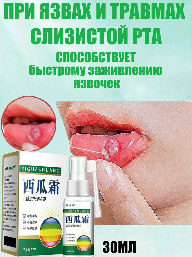 Спрей для полости рта 30 мл