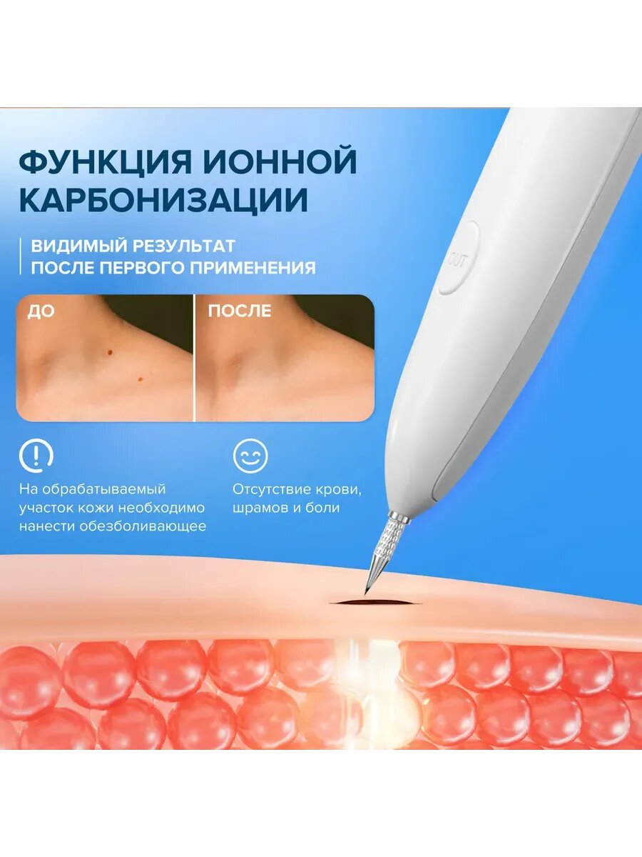 Косметический аппарат KINGrinder, для ухода за кожей, от бородавок, микротоковый
