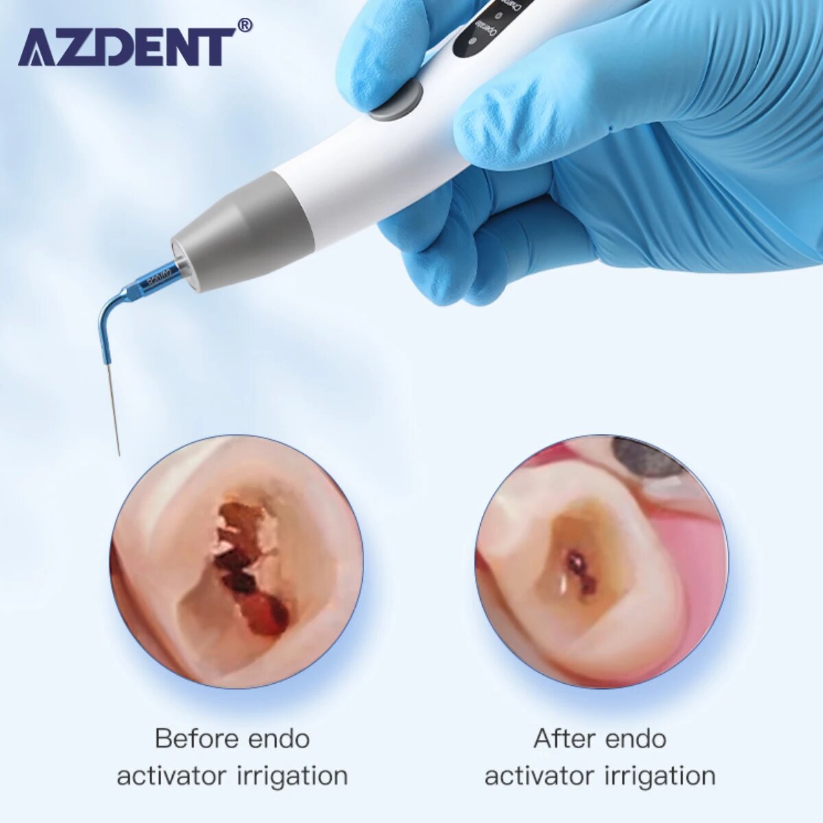 AZDENT ENDO Ultra Activtor Звуковой ирригатор для корневых каналов EU Plug