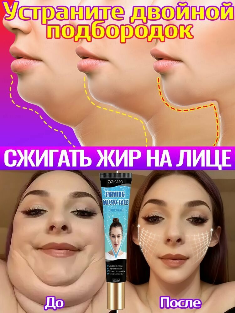 Крем-лифтинг V-face для удаления излишков жира, укрепления кожи, устранения двойного подбородка, для омолаживающего массажа.20 г