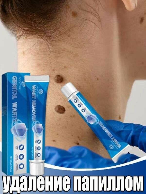 LUKAOHUA / Мазь от бородавок, Крем средство для удаления бородавок, папиллом и родинок, безболезненно, не оставляет следов без побочных эффектов / 20г