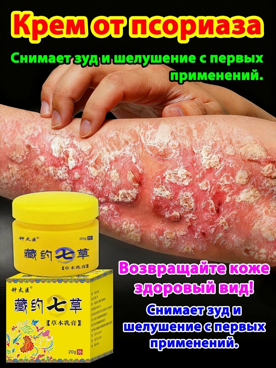 Китайская чудо мазь от псориаза и прыщей