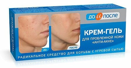 До И после Крем-гель д/лица Анти-акне 50мл