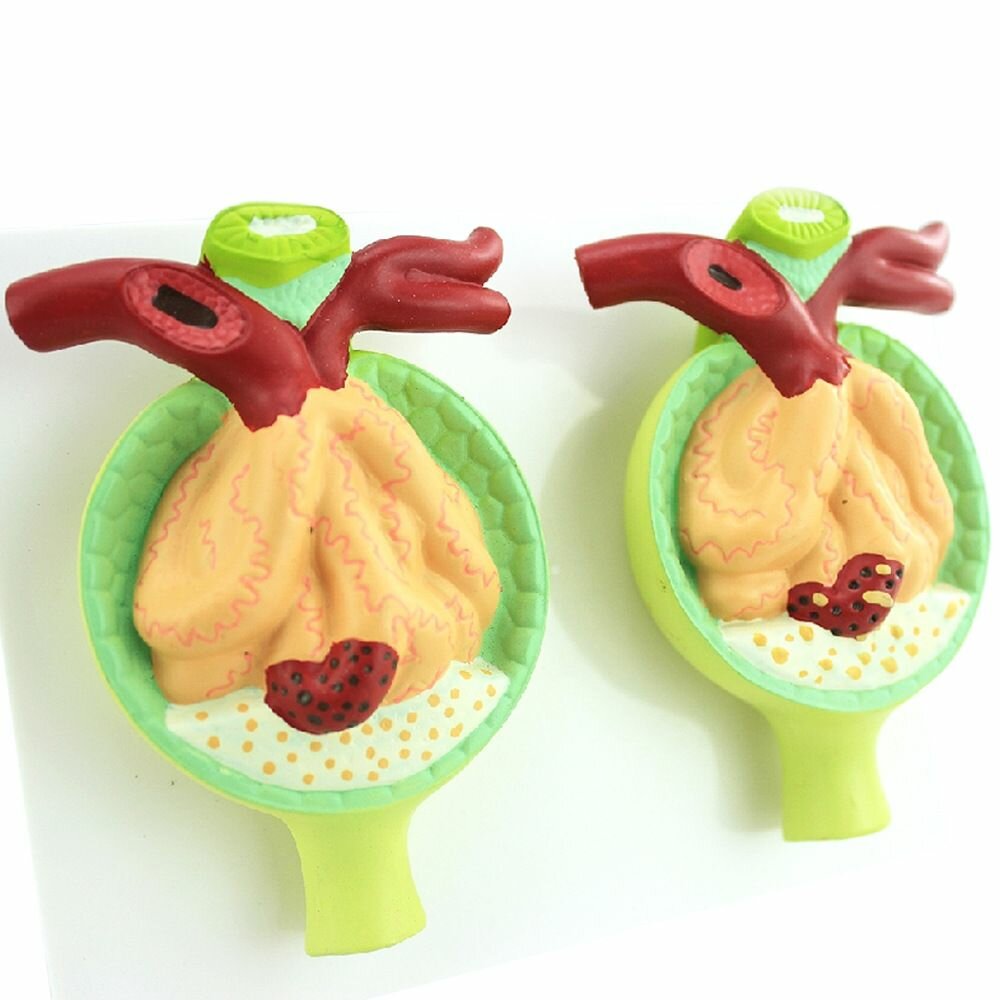 Модель протеинурии у человека