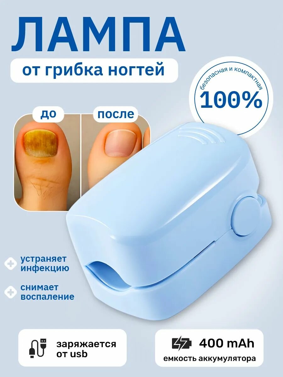 Лампа от грибка ногтей "Ультра", синий/фиолетовый свет, аккумулятор, 1 шт