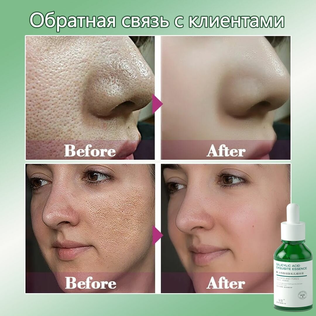 Сыворотка для лица — фото 1
