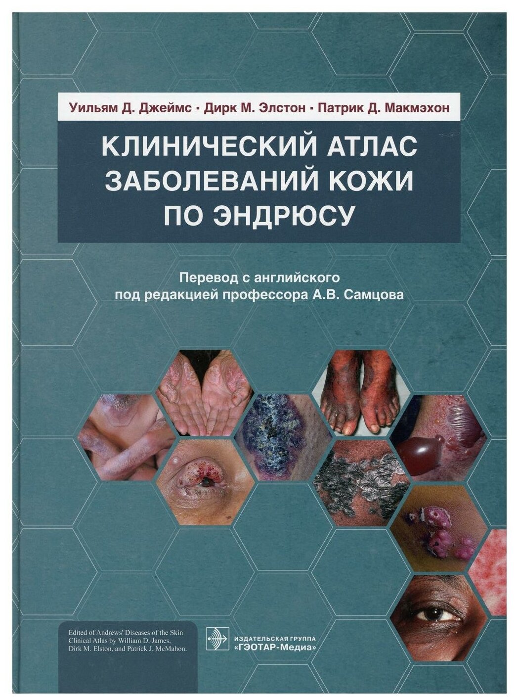 Клинический атлас заболеваний кожи по Эндрюсу. Джеймс У. Д, Элстон Д. М, Макмэхон П. Д. Гэотар-медиа