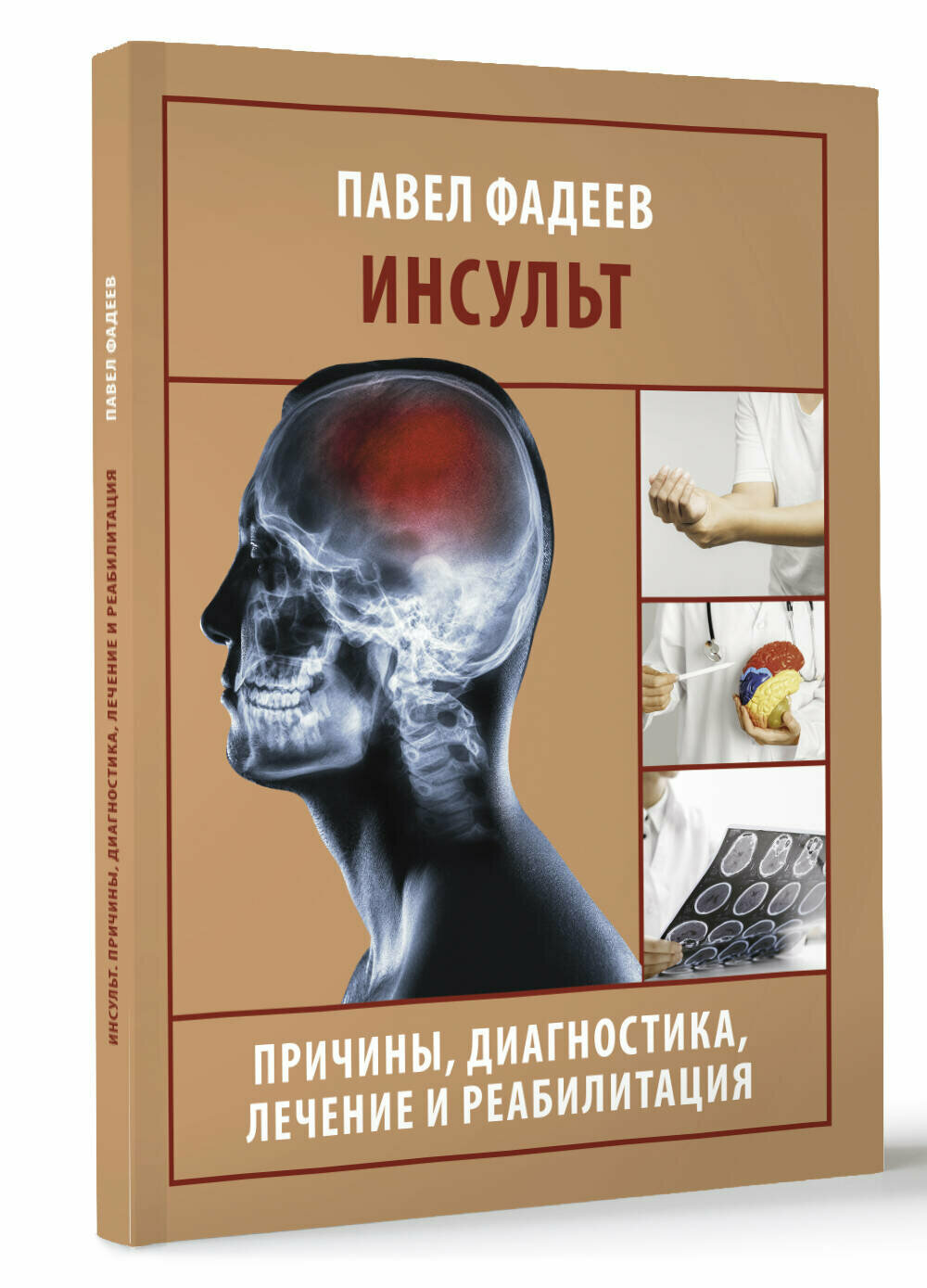Инсульт. Причины, диагностика, лечение и реабилитация Фадеев П. А.