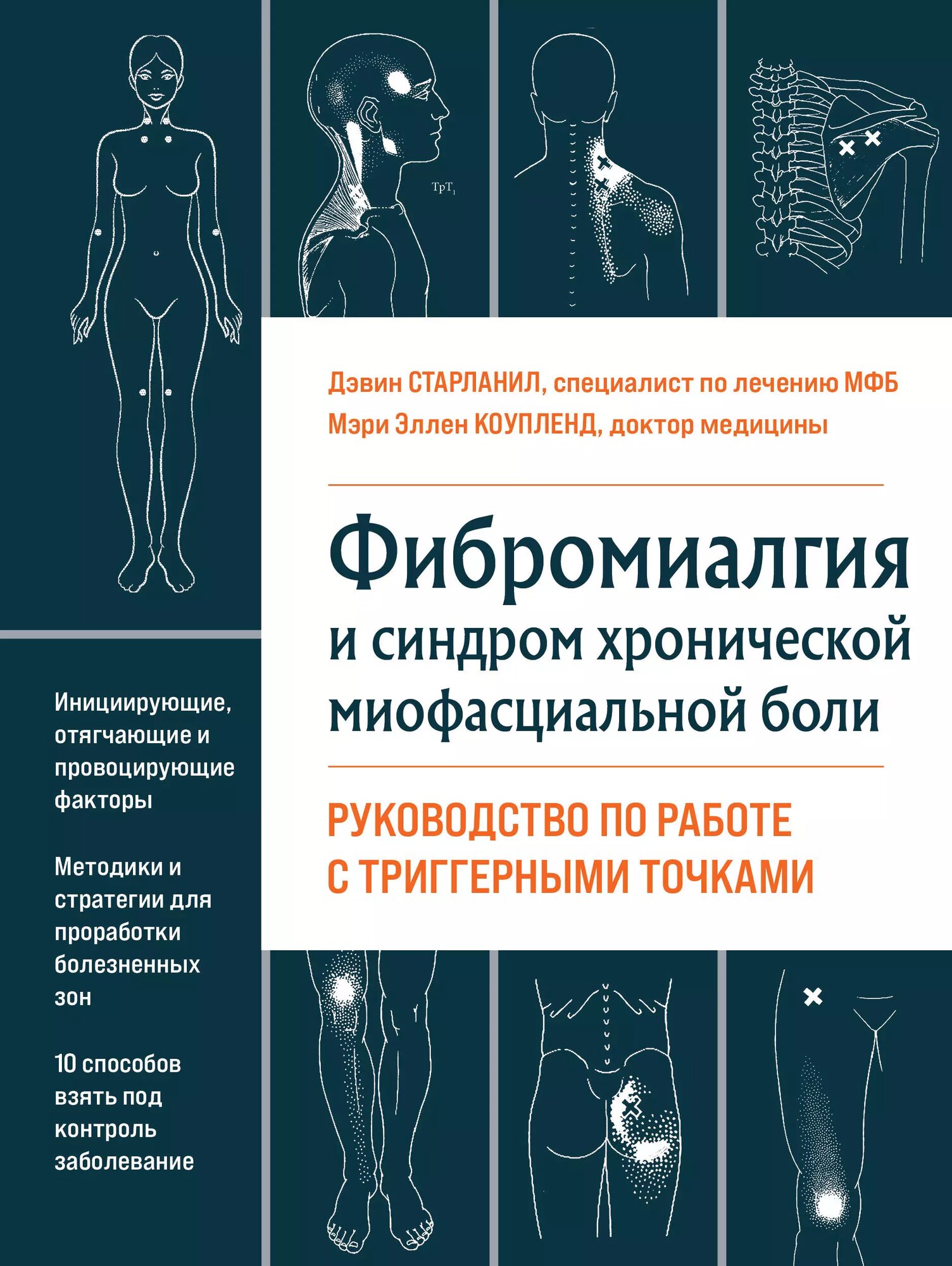 Фибромиалгия и синдром хронической миофасциальной боли. Руководство по работе с триггерными точками(Мэри Эллен Коупленд, Дэвин Старланил)