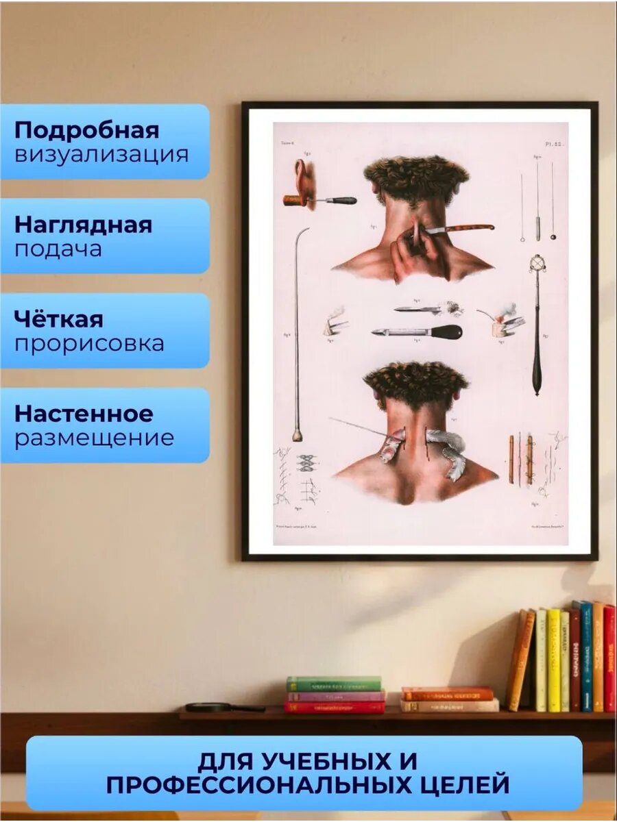 Постер медицинский, перфа, оперативная хирургия, А3 анатомия, хирургия