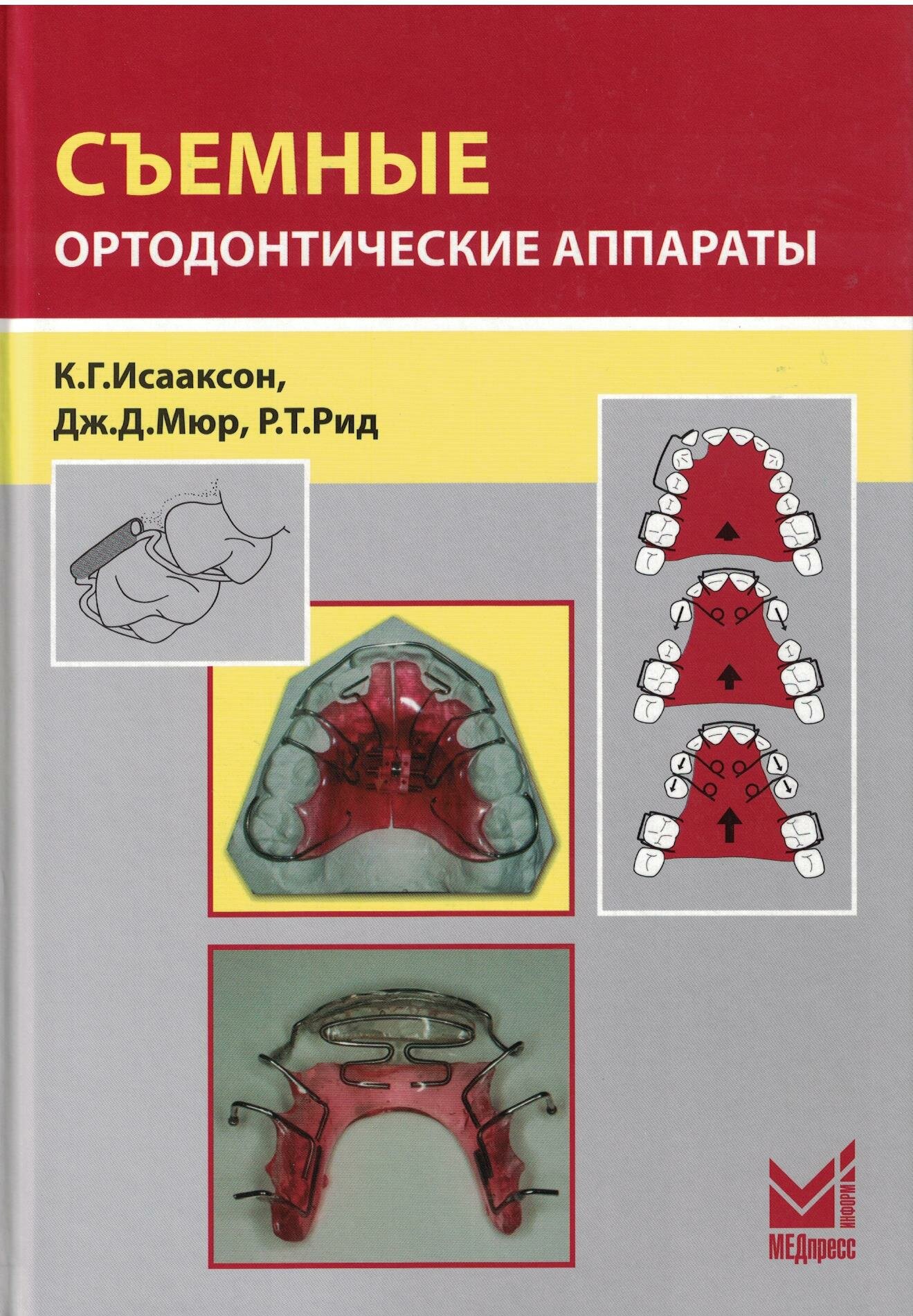 Съемные ортодонтические аппараты