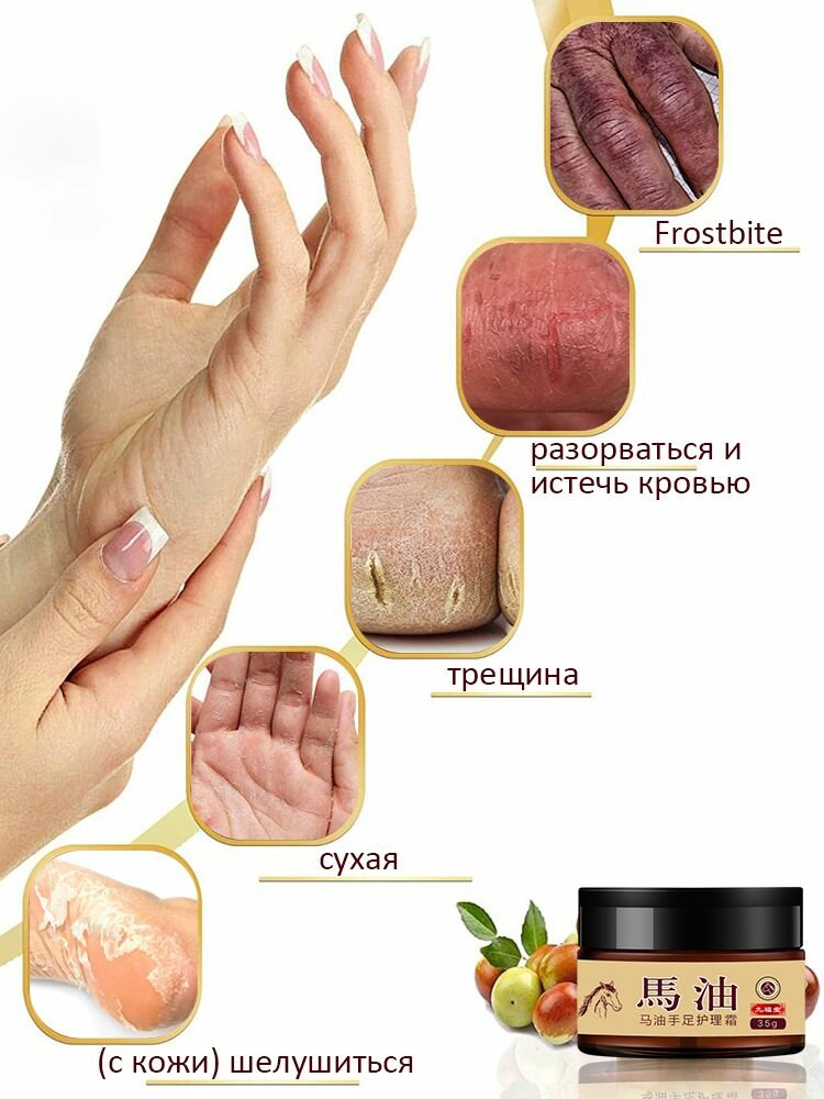 Скорая помощь пяткам! Крем с мочевиной 40% и конским жиром 35г Глубокие трещины исчезают за 5 дней, экстренное смягчение огрубевшей кожи, защита от рецидива