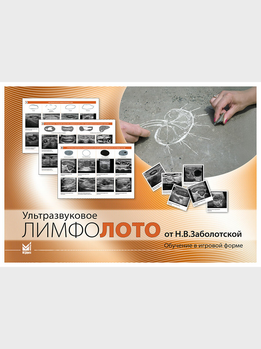 Ультразвуковое лимфолото Н. В. Заболотской, обучение в игровой форме