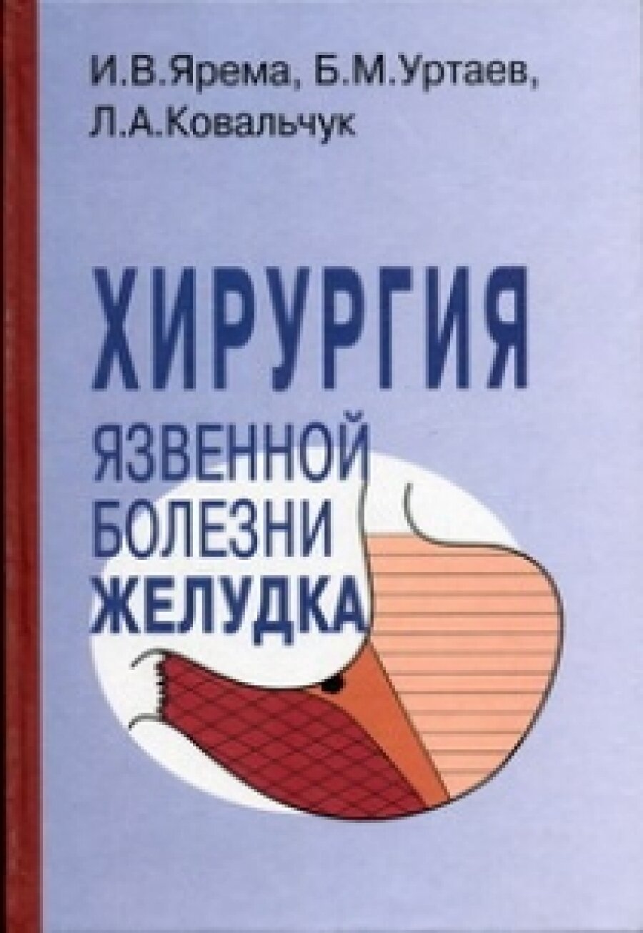 Хирургия язвенной болезни желудка: Руководство для врачей