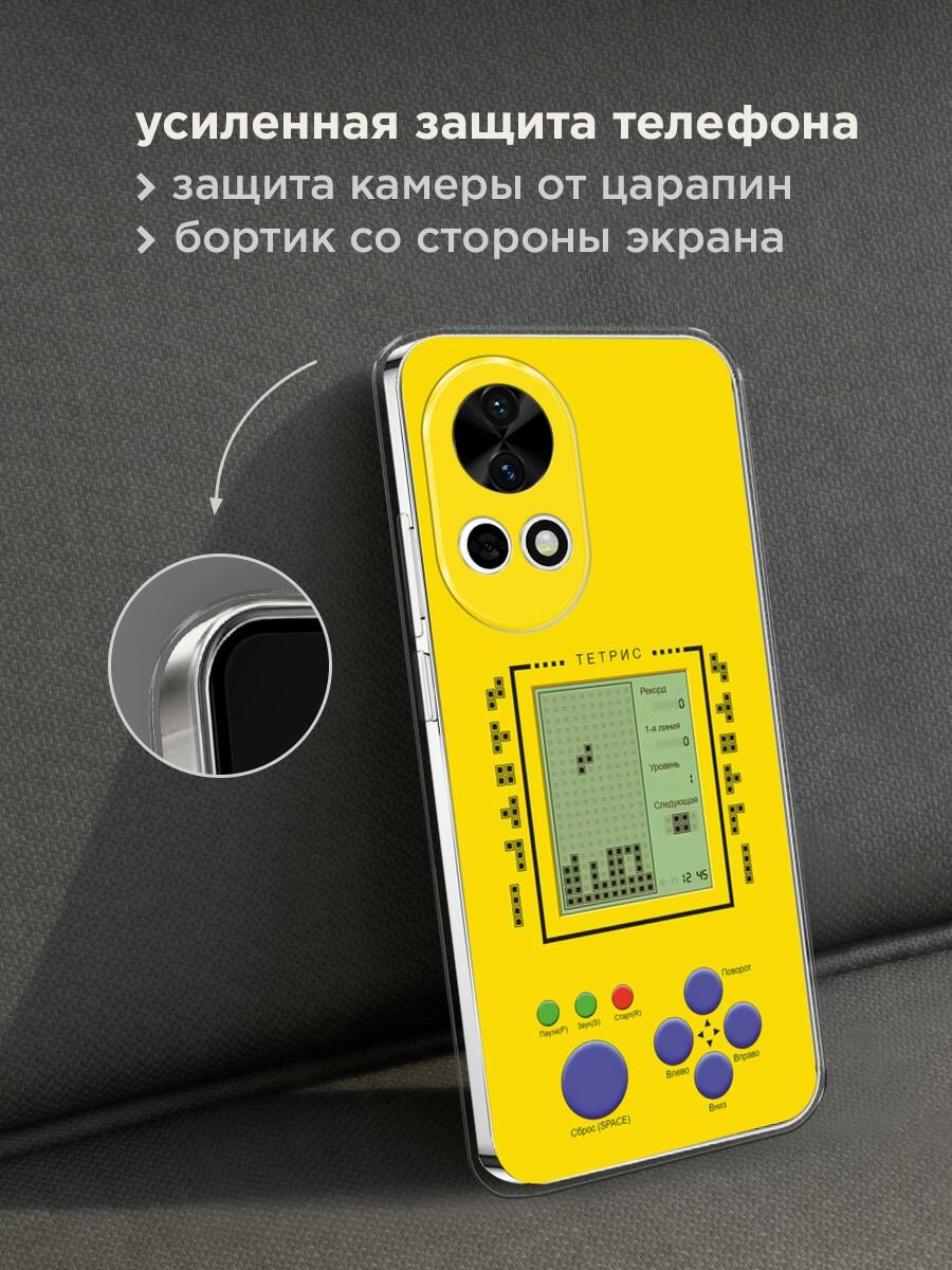 Чехол на Huawei Nova 12/Nova13 / Хуавей Нова 12/Нова 13 с принтом Желтый тетрис — фото 1
