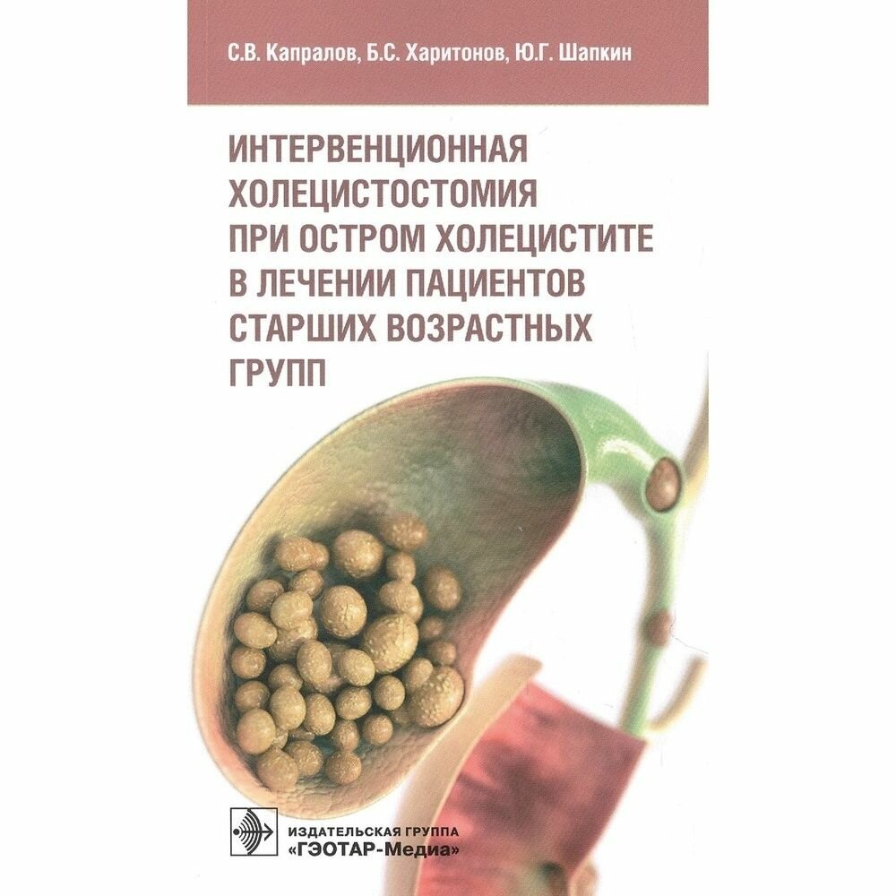 Книга гэотар-медиа Интервенционная холецистостомия при остром холецистите в лечении пациентов старших возрастных групп. 2022 год, Капралов, Харитонов