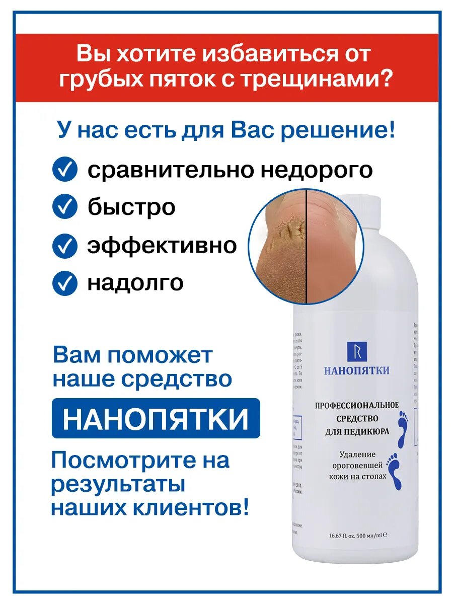 Набор для ухода за пятками: средство и пемза