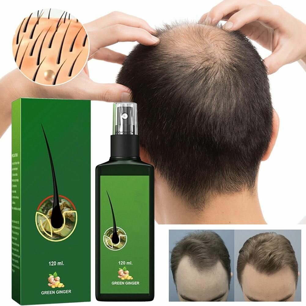 Спрей для роста волос 30/120 мл, питает и ухаживает за кожей головы, предотвращает выпадение волос