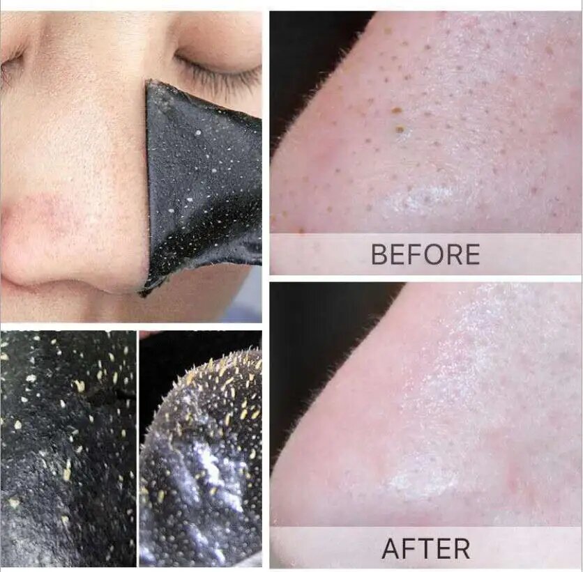 10 шт, маска для удаления черных точек на носу