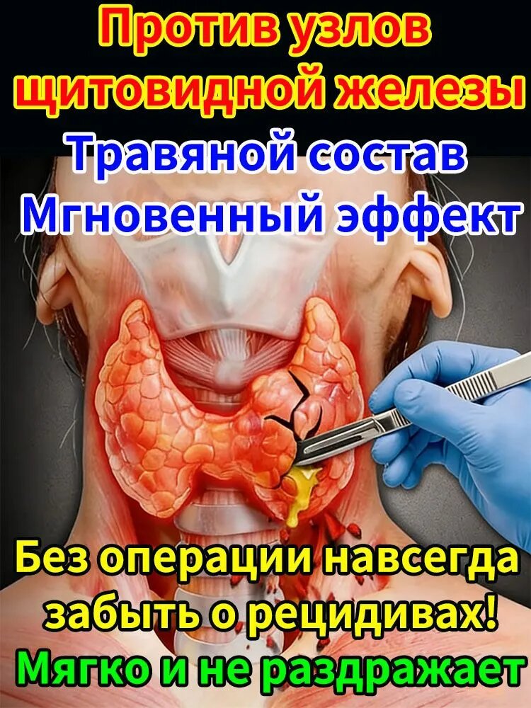 Крем при щитовидке от диффузных изменений и узлов
