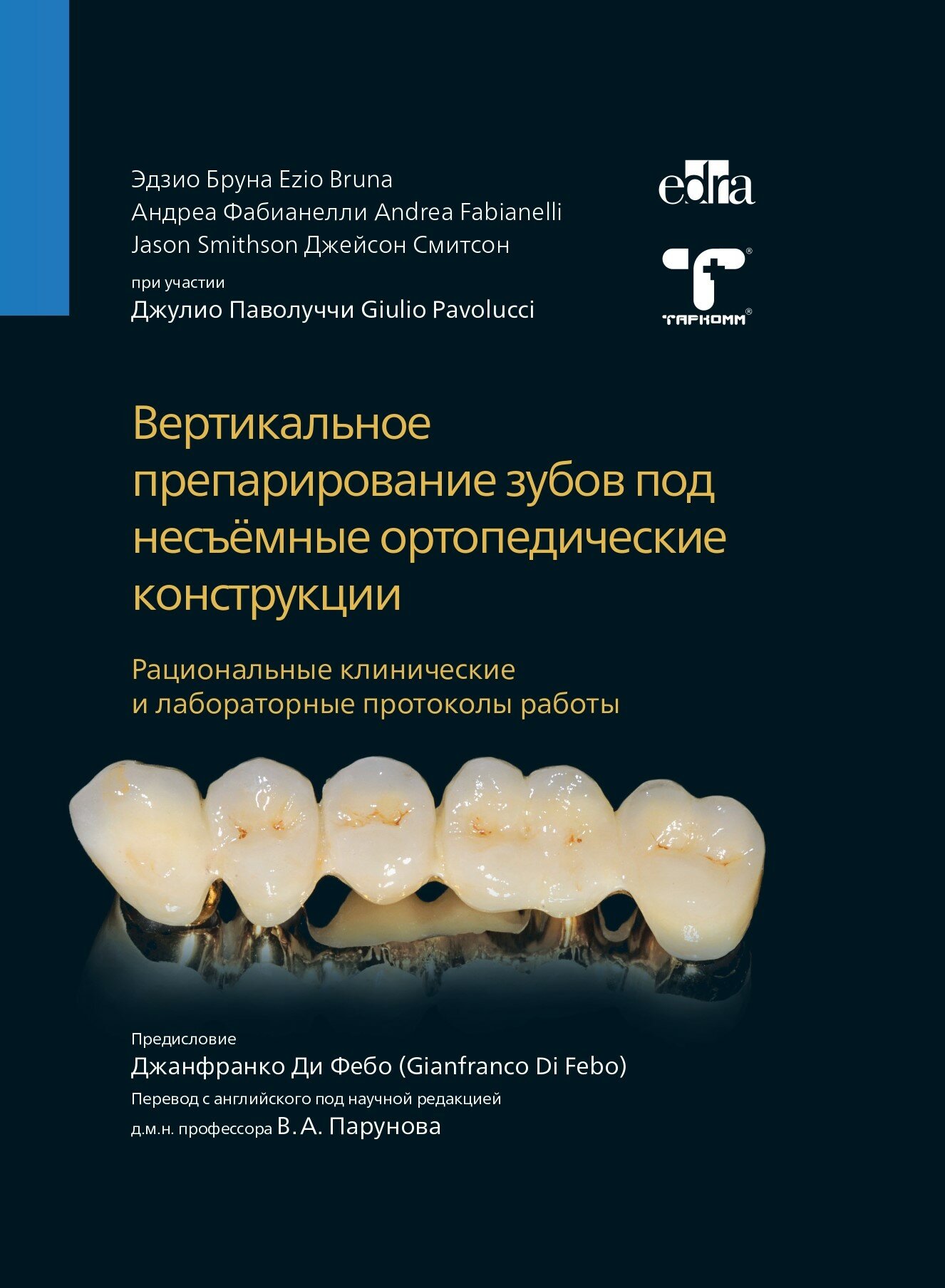 Вертикальное препарирование зубов под несъёмные ортопедические конструкции