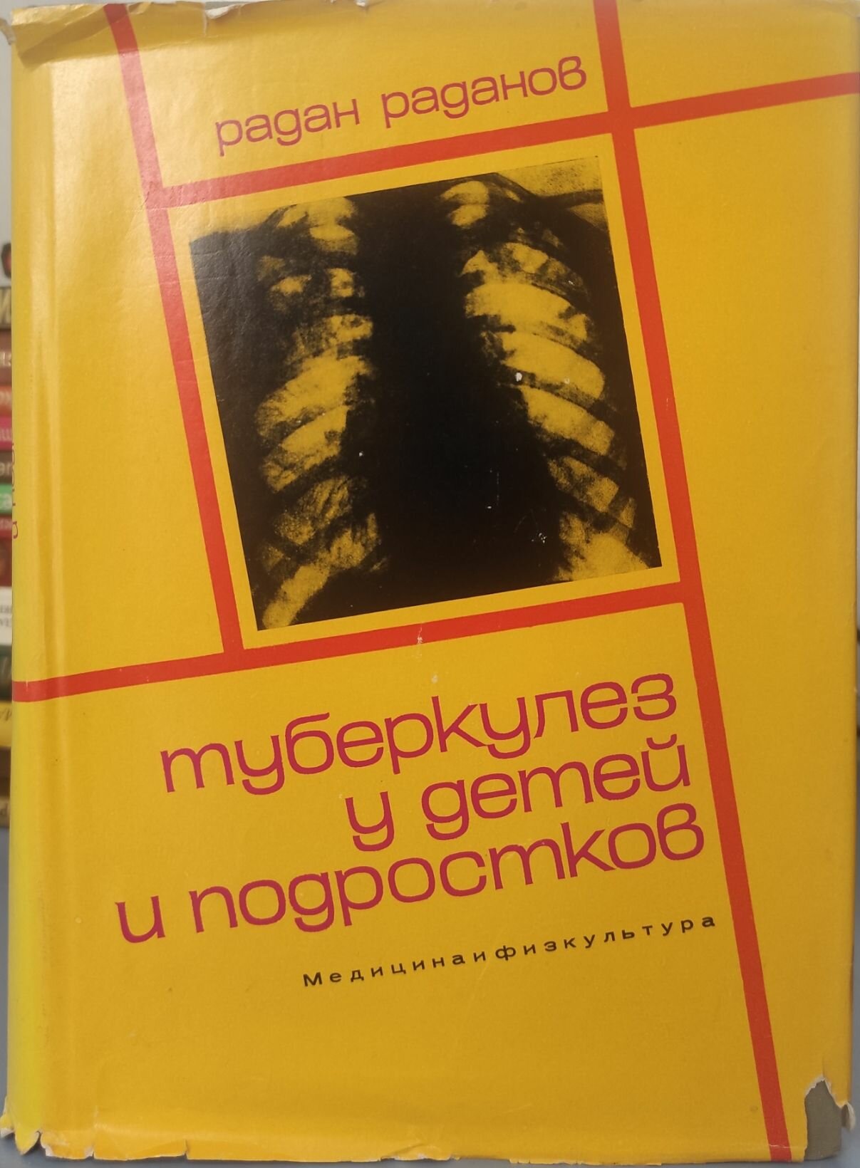 Туберкулез у детей и подростков. Радан. Медицина и физкультура. 1967. Твердый переплет, суперобложка. 548 стр