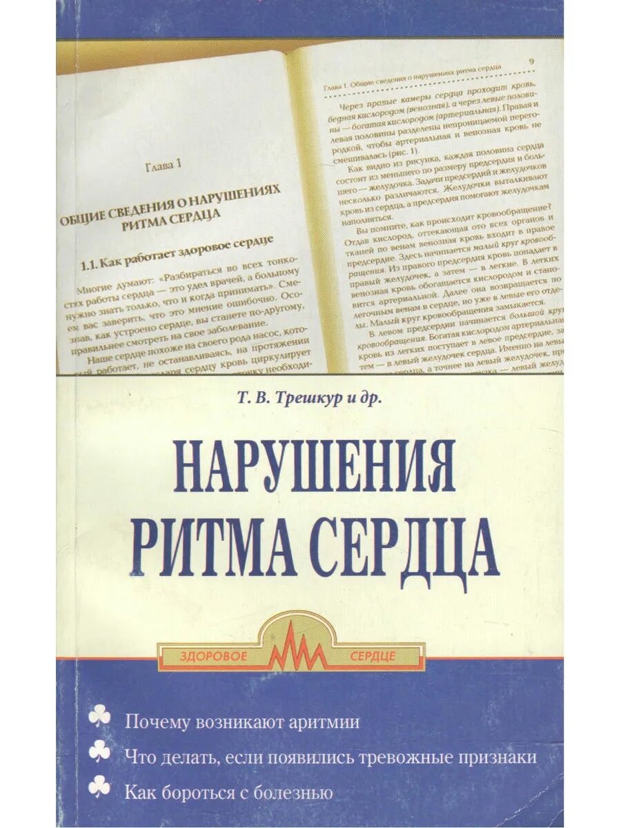 Нарушение ритма сердца