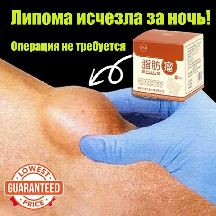 Крем для удаления подкожных припухлостей щитовидная железа липомы 30 г, показан при отечности кожи, целлюлите, фиброзном жировике