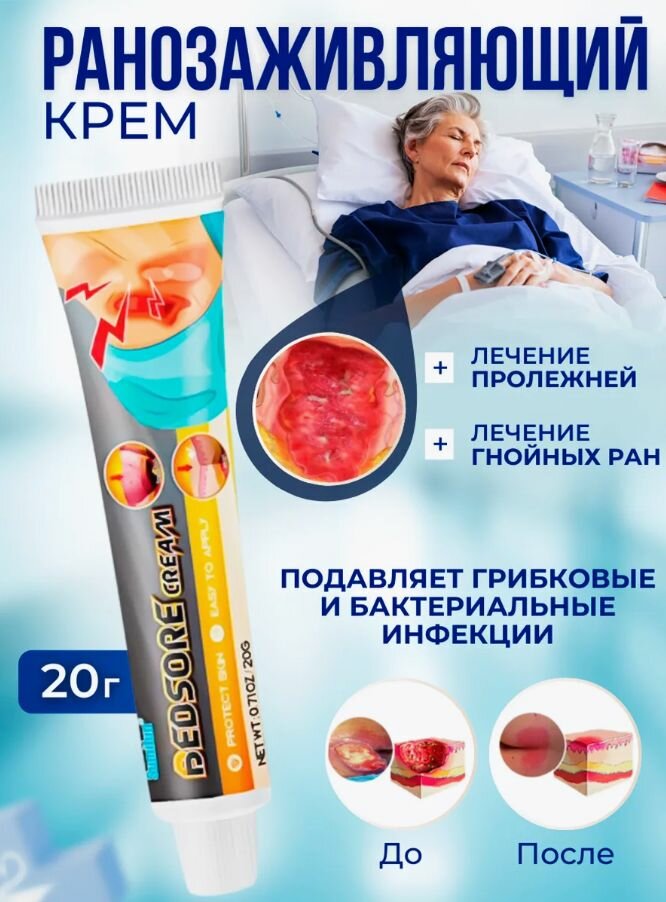 Крем для устранения пролежней sumifun, используемый для ухода за поврежденными ступнями и ягодицами