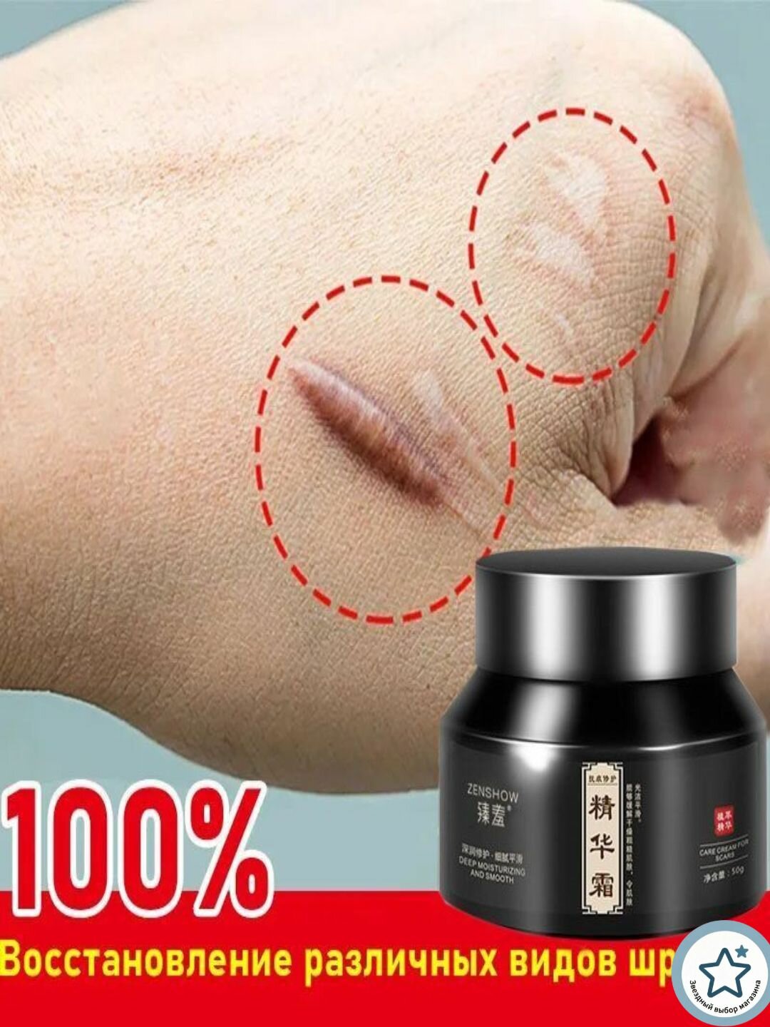 Натуральный крем для устранения растяжек и постакне: восстанавливает кожу после беременности, уменьшает шрамы от прыщей, гипоаллергенный с экстрактами трав