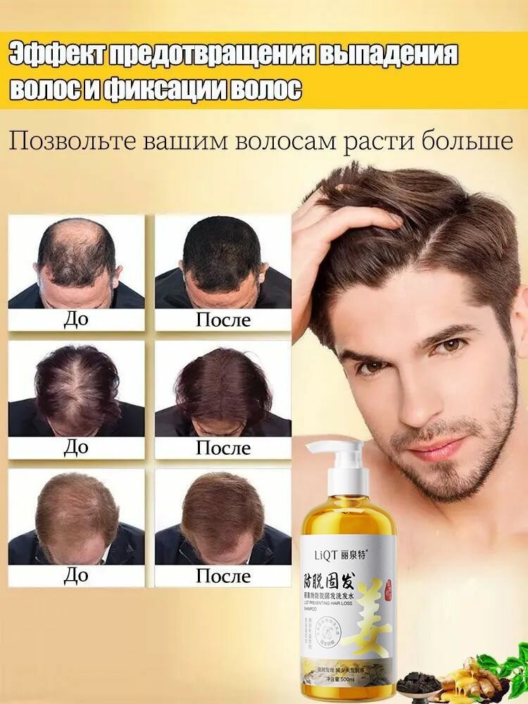 Имбирный шампунь, 1500 мл, для жирной кожи головы, против перхоти, для волос склонных к выпадению, укрепление и рост, для всех типов волос, имбирем и экстрактом женьшеня