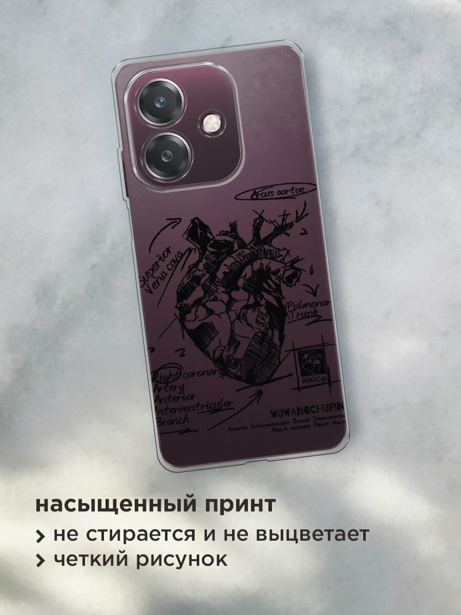 Чехол на Oppo A3/A3x / Оппо А3/A3x с принтом "Анатомическое сердце 2", прозрачный — фото 1